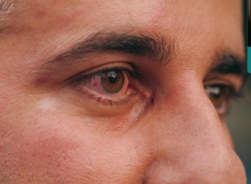 Caucasian Knot | Two people were attacked before a rally in Tbilisi ...